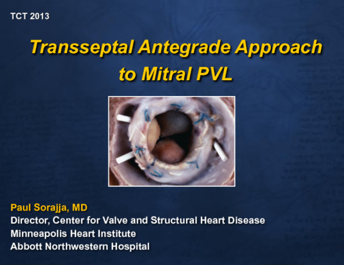 Case I: Transseptal Antegrade Approach to a Mitral Valve PVL | tctmd.com