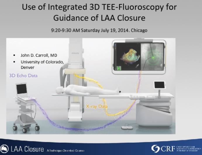 Use of Integrated 3D TEE-Fluoroscopy for Guidance of LAA Closure ...