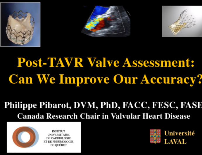 Post-TAVR Valve Assessment: Can We Improve Our Accuracy? | tctmd.com