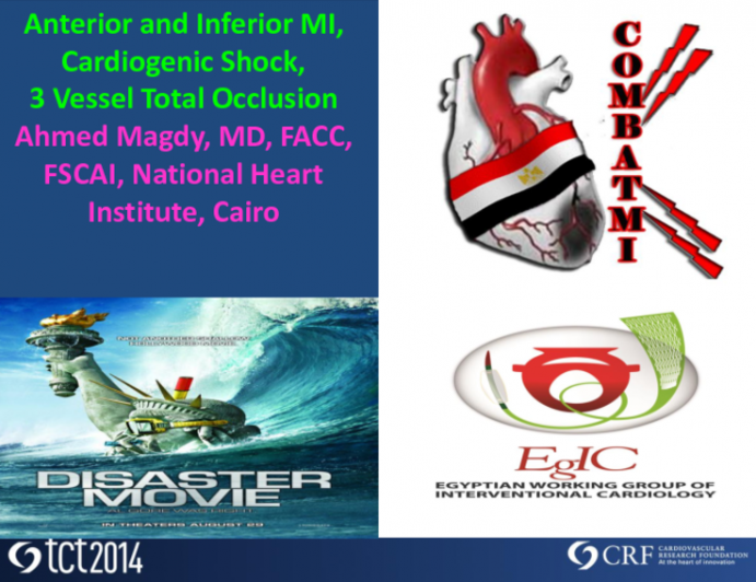 Hemodynamic Support in Complex PCI | tctmd.com