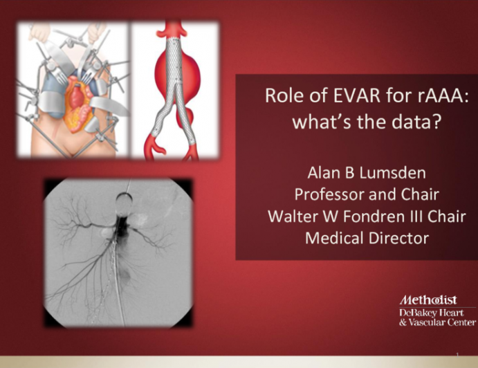Role of EVAR in the Treatment of Ruptured AAA: Evidence and Evolving ...