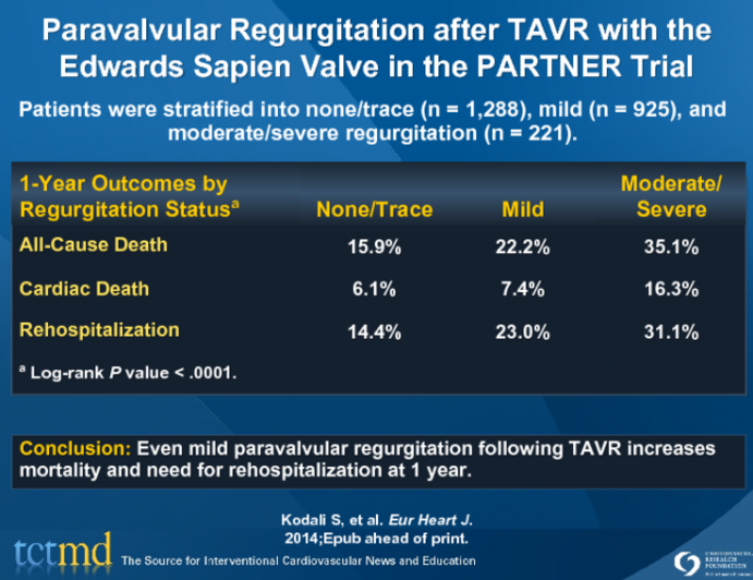Paravalvular Regurgitation after TAVR with the Edwards Sapien Valve in ...