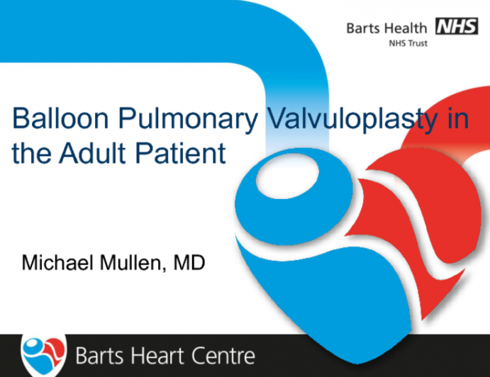 Balloon Pulmonary Valvuloplasty in the Adult Patient | tctmd.com