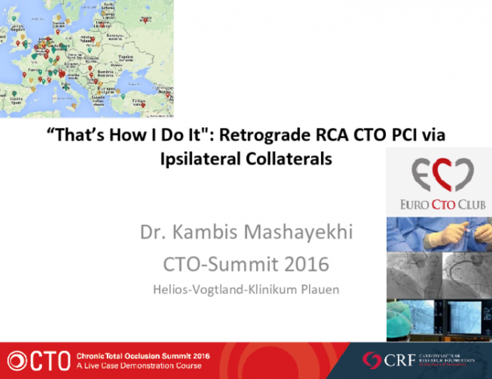 That’s How I Do It: Retrograde RCA CTO PCI via Ipsilateral Collateral ...