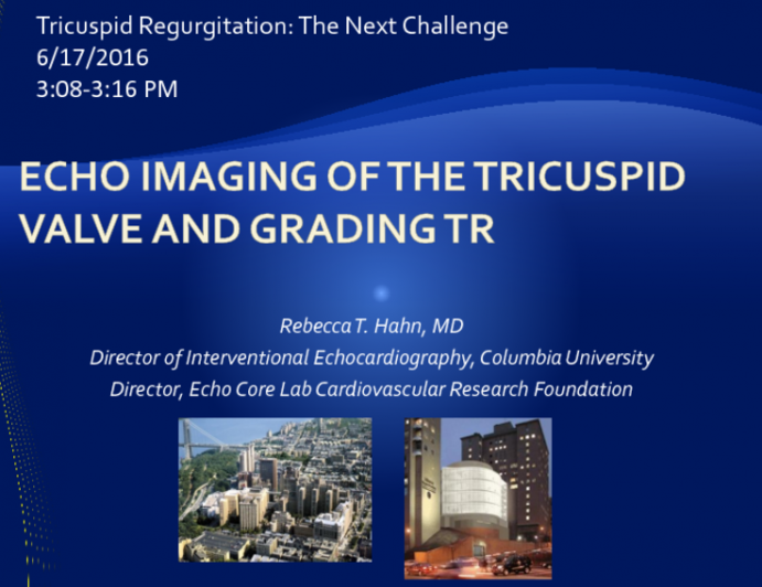 Echo Imaging of the Tricuspid Valve and Grading TR Severity | tctmd.com