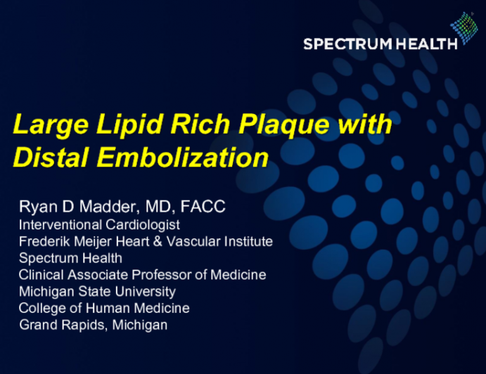 Case #5: Large Lipid Rich Plaque With Distal Embolization | tctmd.com