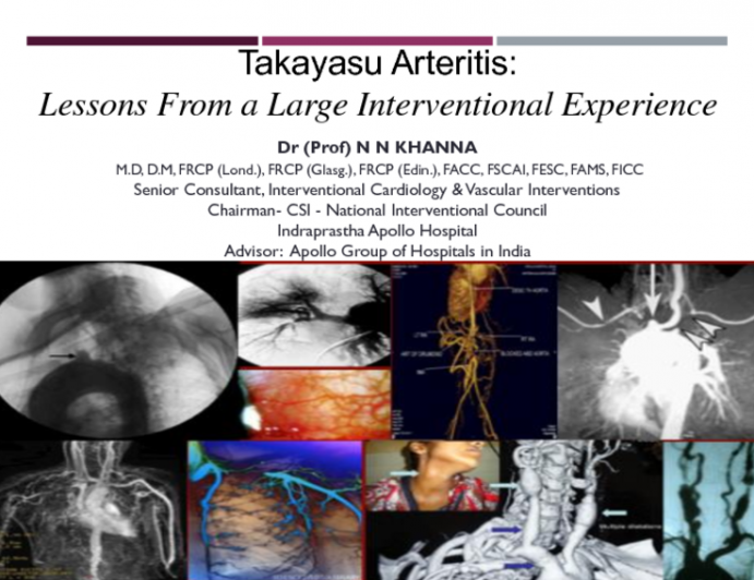 Takayasu s Arteritis: Lessons From a Large Interventional | tctmd.com