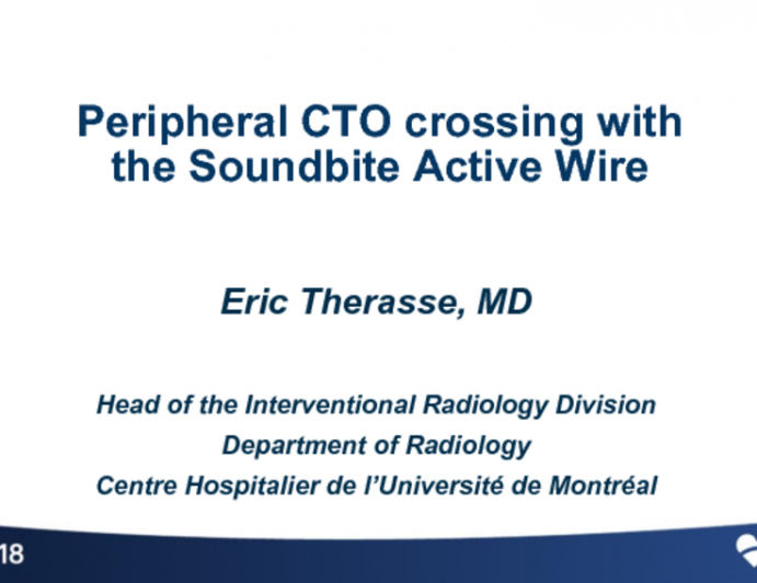 Peripheral CTO crossing with the SoundBite Active Wire (SoundBite ...