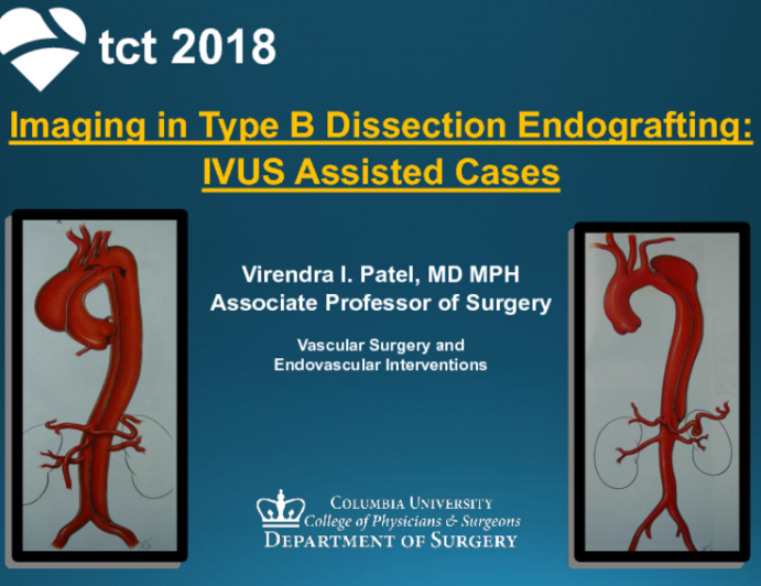 Imaging in Type B Dissection Endografting: IVUS Assisted Techniques ...