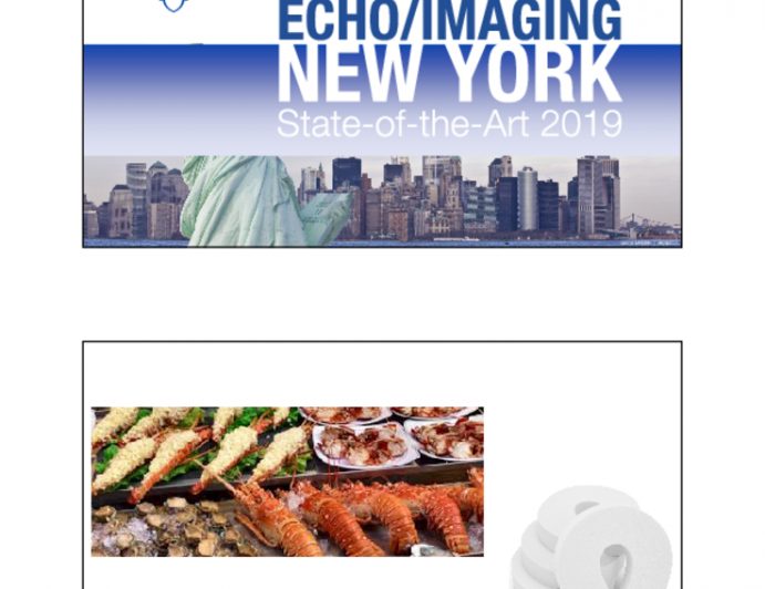 Diastolic Function Guidelines | tctmd.com