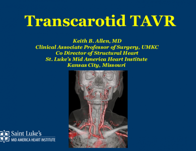 Transcarotid Is My Preferred Alternative Access for TAVR | tctmd.com