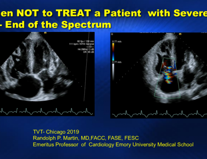 When NOT to TREAT a Patient With Severe TR – Ends of the Spectrum ...