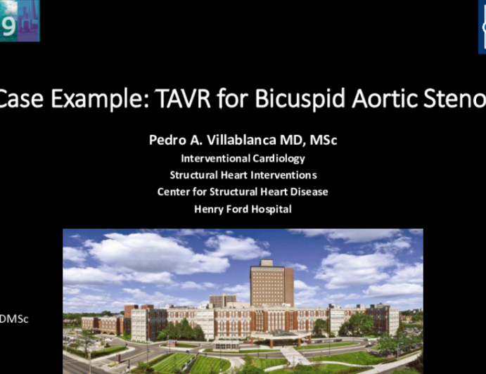 Case Example: TAVR for Bicuspid Aortic Stenosis | tctmd.com