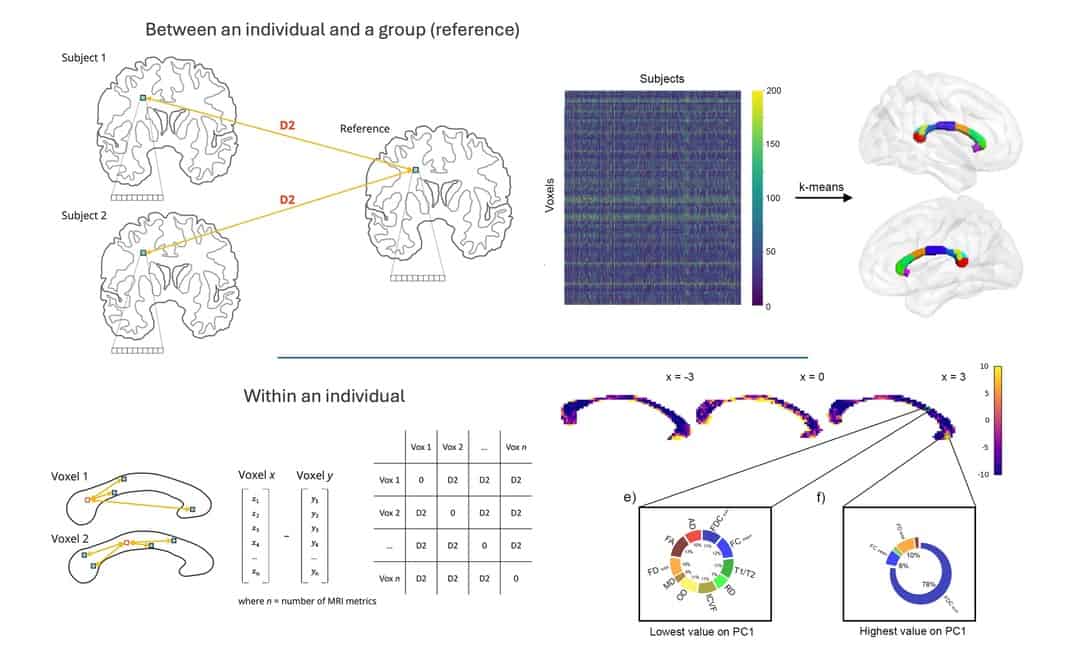 MVComp toolbox: MultiVariate Comparisons of brain MRI features accounting for common information ...