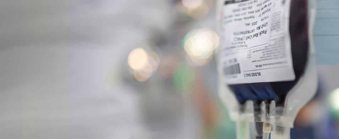 Transfusion-Associated Circulatory Overload (TACO): Strategies to ...