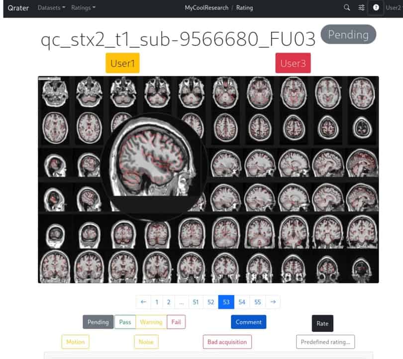 QRATER: a collaborative and centralized imaging quality control web ...