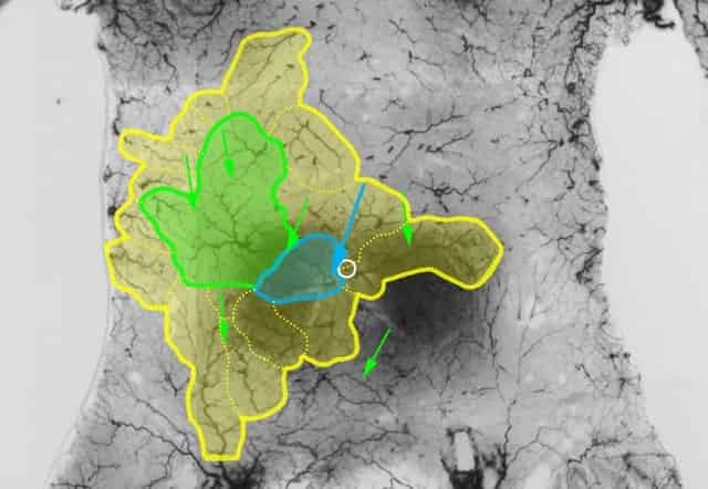 Understanding the vascular anatomy of zone IV in DIEA perforator flaps ...