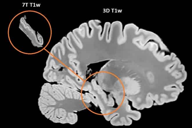 The Douglas-Bell Canada Brain Bank Post-mortem Brain Imaging Protocol ...