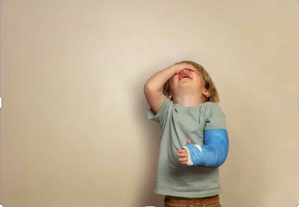 Comminuted, displaced, and angulated distal radial and ulnar ...