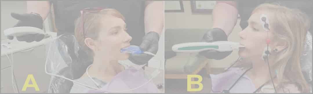 Absolute Maximum Bite Force Changes in Orofacial Pain Patients ...