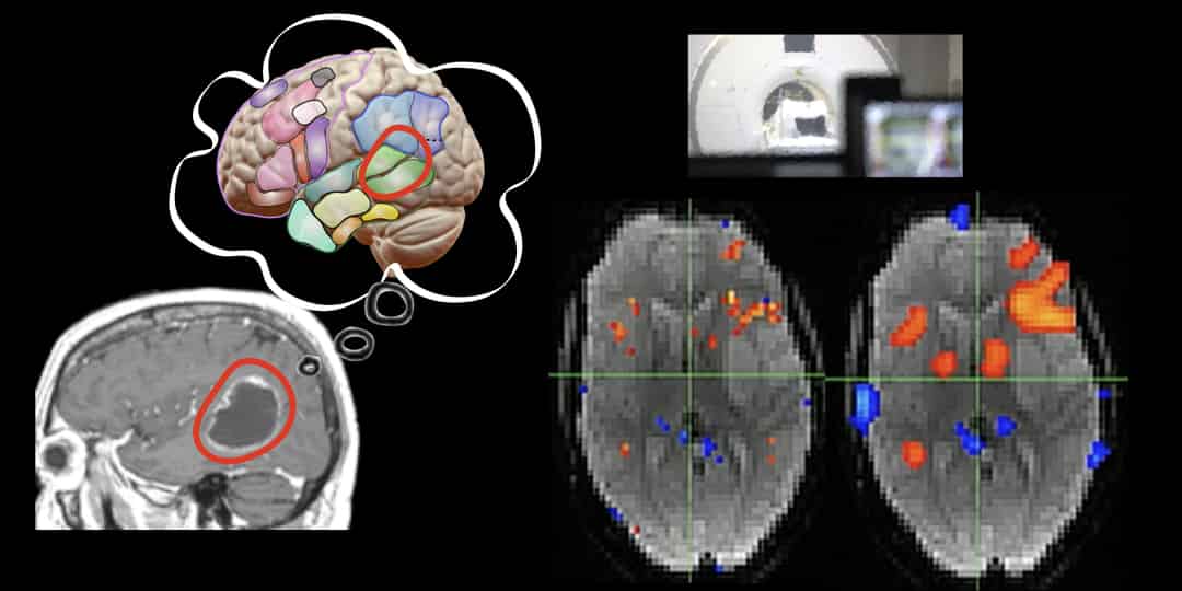 Consensus recommendations for clinical functional MRI applied to ...