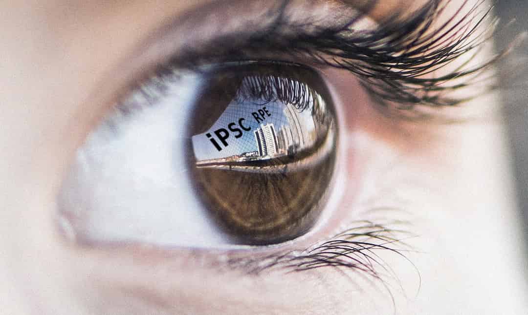 Optimizing Induced Pluripotent Stem Cells stability and reprogramming ...