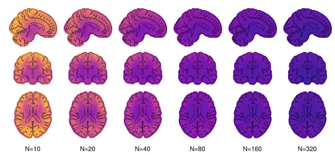 Understanding variability in brain MRI templates: Optimal sample sizes ...