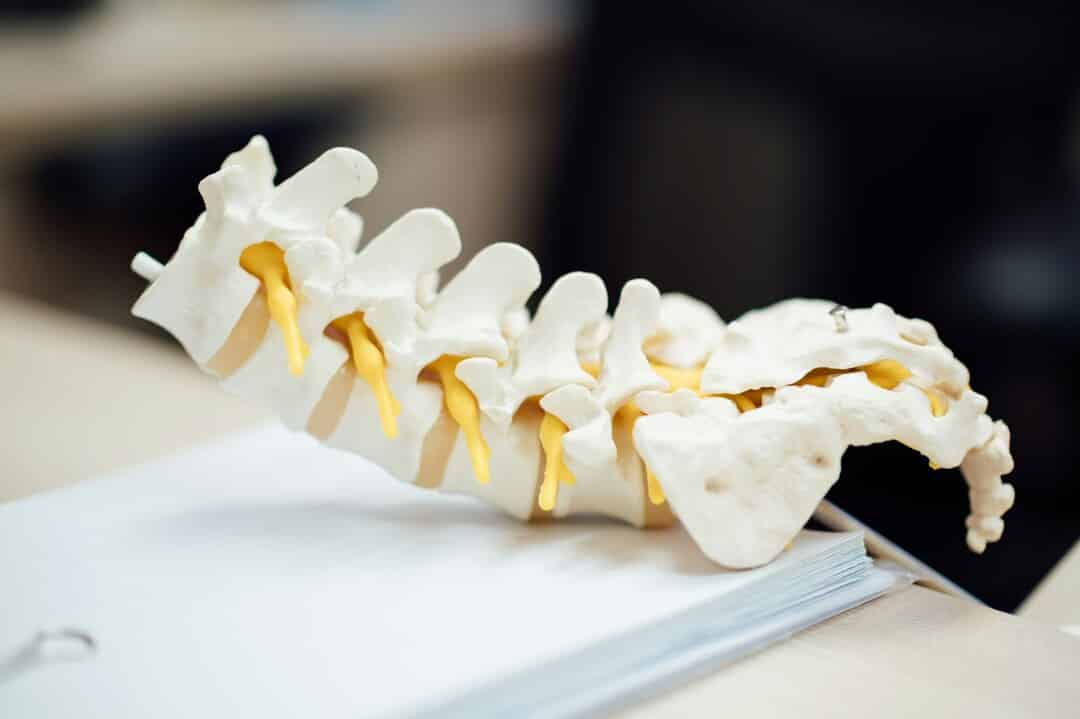 CLINICAL AND IMAGING OUTCOMES OF NON-SURGICAL SPINAL DECOMPRESSION FOR ...