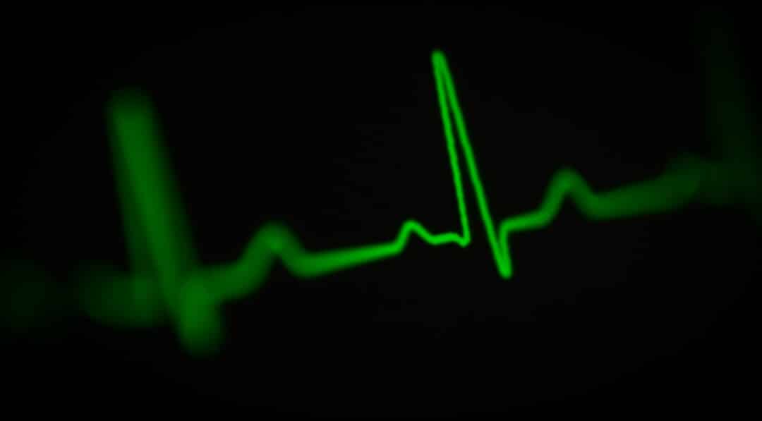 New Onset Heart Failure due to Left Atrial Myxoma | Published in ...