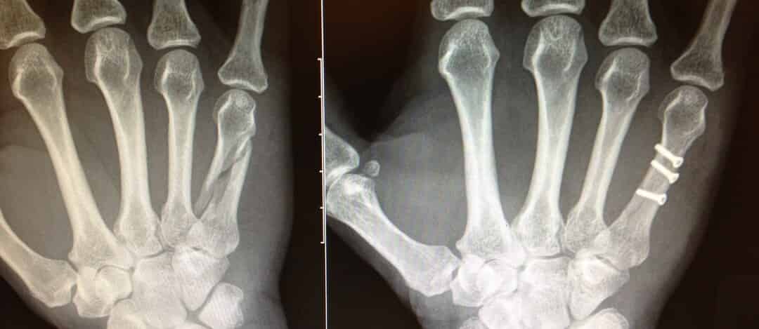 The Majority of Abstracts Presented at the American Association for ...