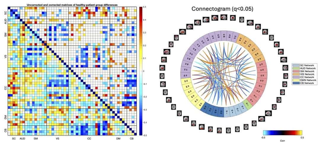 Fully automated estimation of fMRI-guided SPECT brain networks and ...