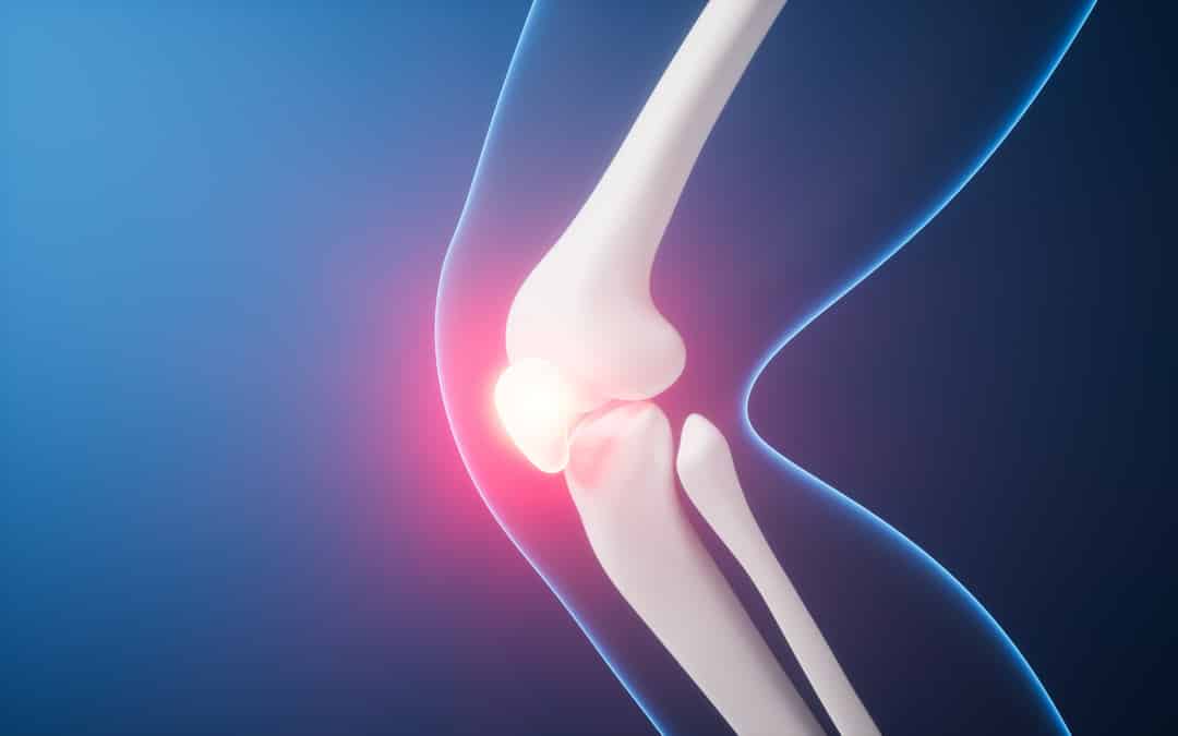 Befit Patelloplasty in TKA: A Targeted Approach to Improve Pain and ...