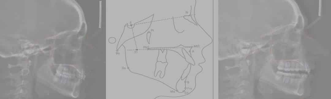 Treatment of Temporomandibular Joint Disorders with an Oral Orthotic ...