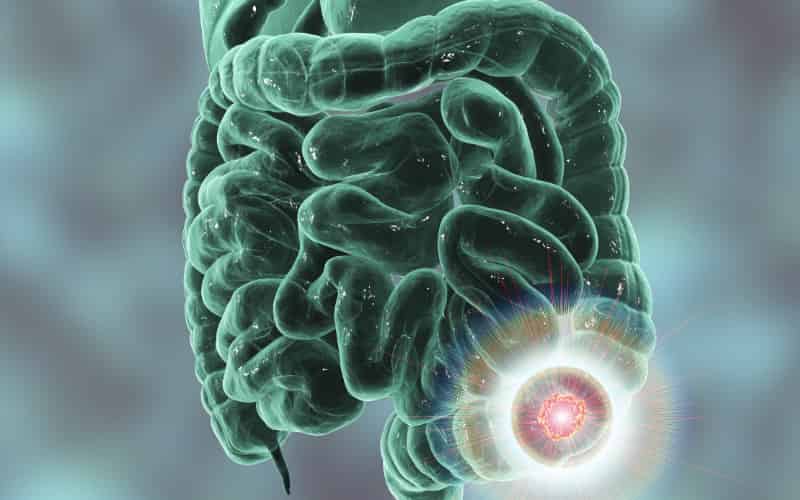 Targeting the Tumor in Colorectal Cancer – Where do we Stand with ...