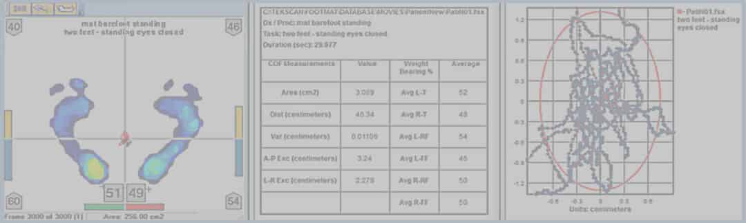 Posture Stability and Forward Head Posture Before and After Disclusion ...