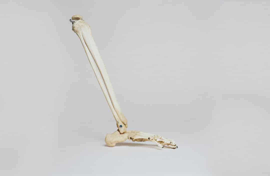 A Review of Proximal Tibia Entry Points for Intramedullary Nailing and ...
