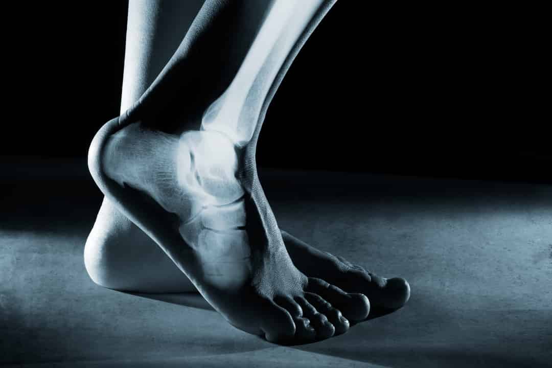 Peripheral nerve block compared to peri-articular injection for ...