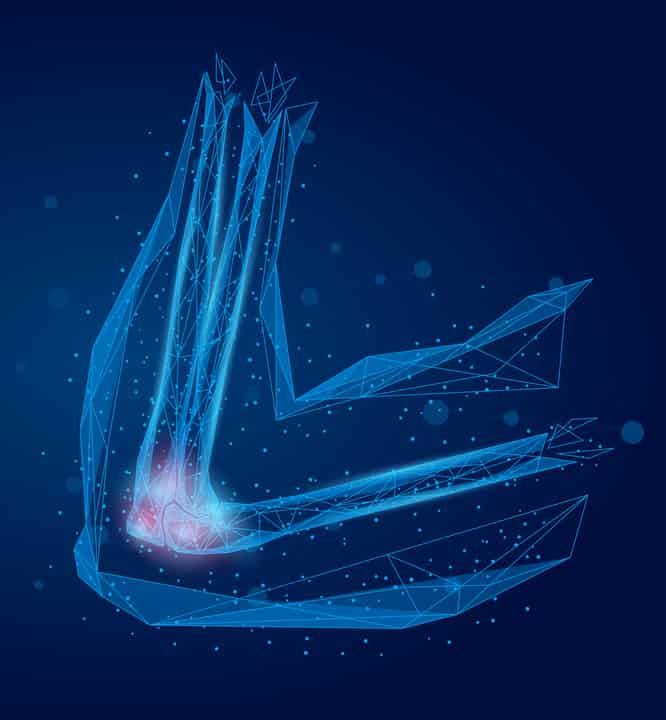 Supine Elbow Arthroscopy: A decade of results with a vertical humerus ...