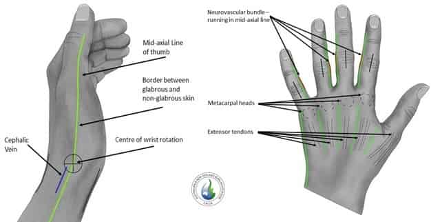 Evaluation of updated National Burn Service escharotomy guidelines ...