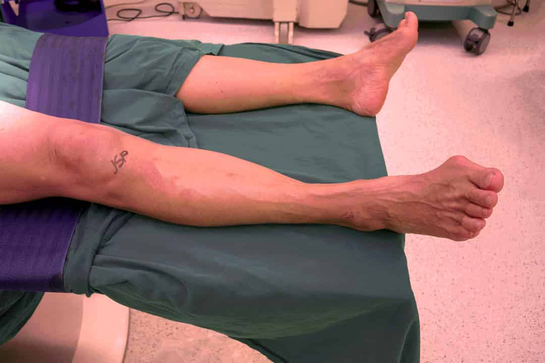 Wrong-Site Surgery in Pennsylvania During 2015–2019: A Study of ...