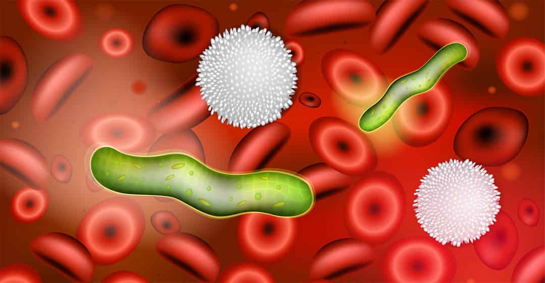 Improving Sepsis Compliance With Human Factors Interventions in a ...