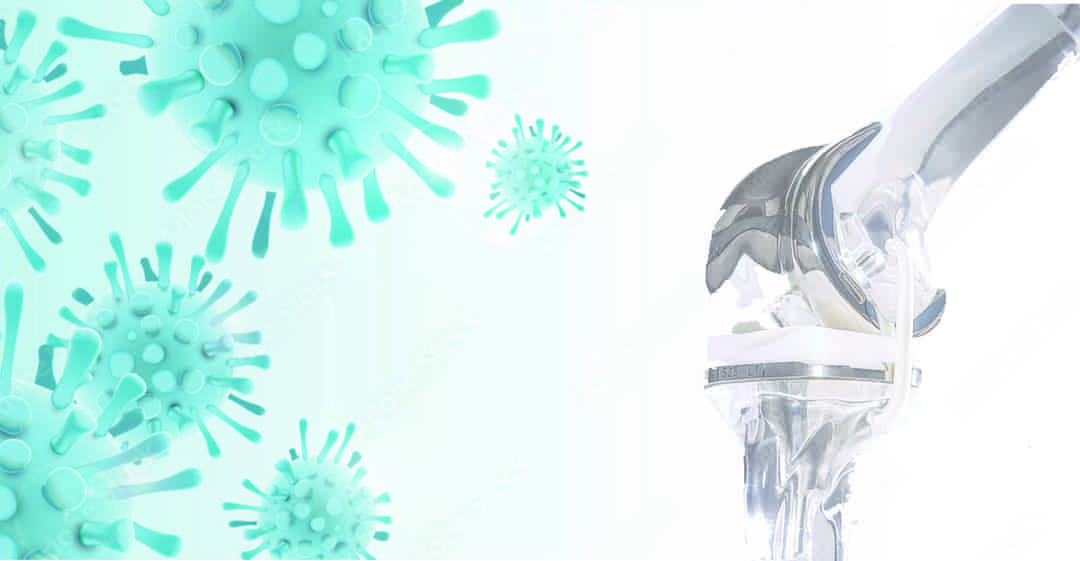 Total Knee Arthroplasty During the COVID-19 Pandemic: Rapid Return to ...