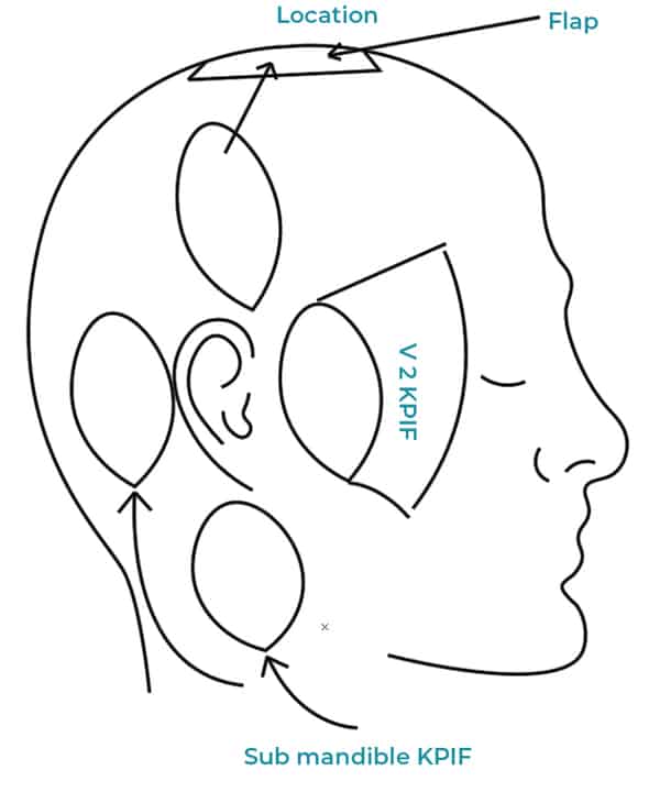 The keystone solution for major head and neck defects: audio-visual ...