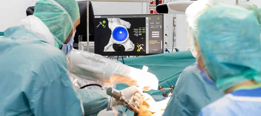 Building a successful robotic-arm assisted orthopedic surgery program ...