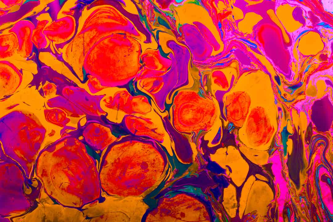 Celebrating Five Years Of “hematology Without Borders” By The
