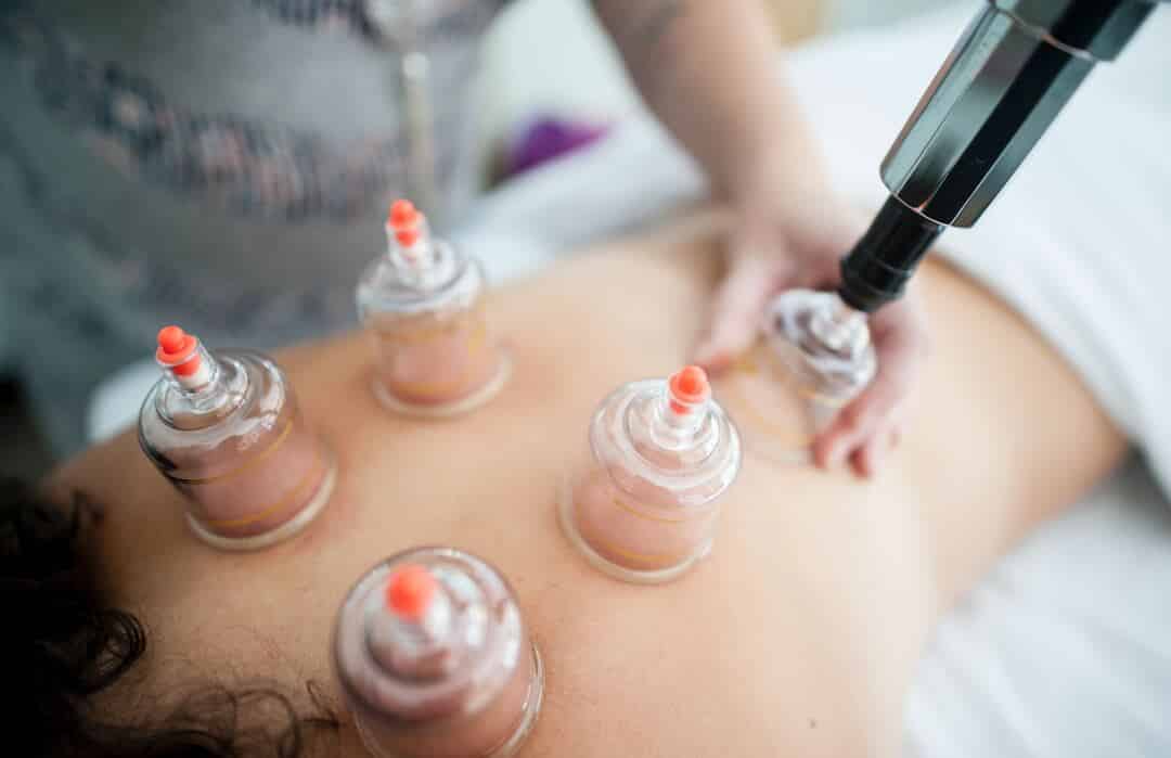 Cupping therapy cost store