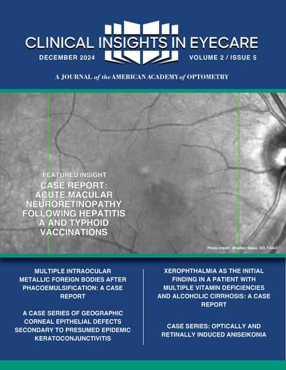 Vol. 2, Issue 5, 2024 | Published by Clinical Insights in Eyecare