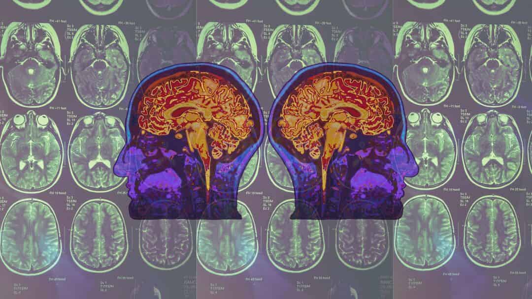 Vol. 5, Issue SI 1, 2025 | Published by Aperture Neuro