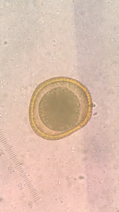 toxocara canis eggs