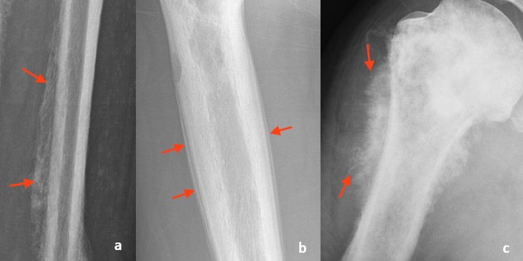 Top 10 Facts to Know about Bone Lesions Identified on Radiographs ...